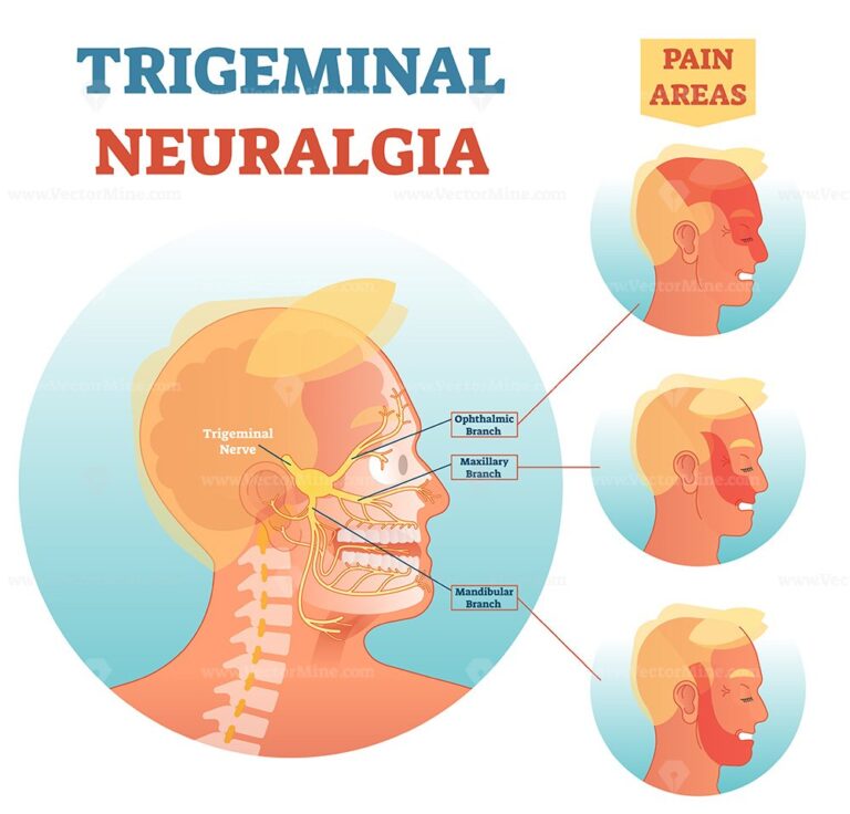 Trigeminal nerve anatomical vector illustration diagram – VectorMine