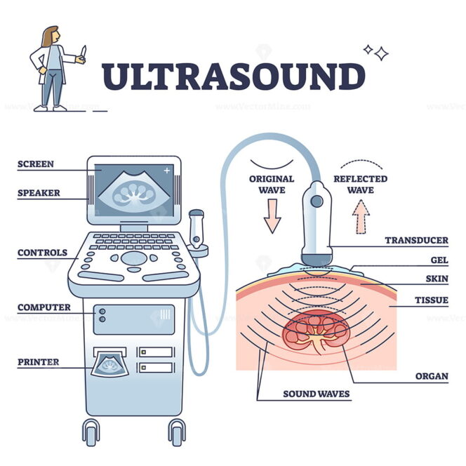 Ultrasound patient analysis process and equipment explanation outline ...