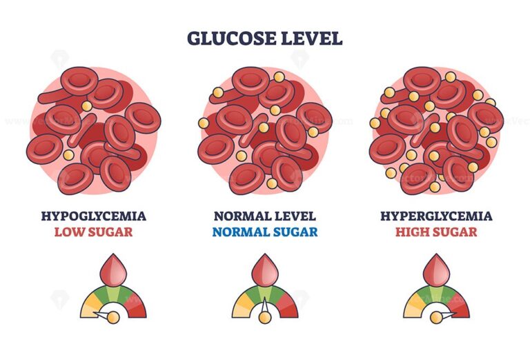 Glucose level with low, normal and high sugar in blood outline diagram ...