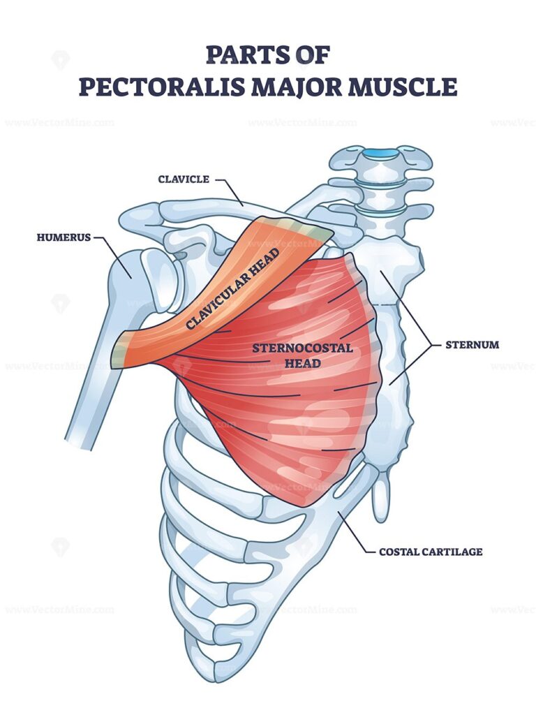 The diagram contrasts pectoralis major and minor muscles, highlighting ...