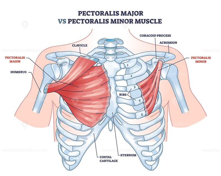 The diagram contrasts pectoralis major and minor muscles, highlighting ...