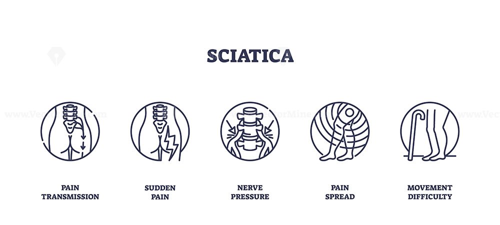 Posture correction diagram shows five side-view silhouettes ...